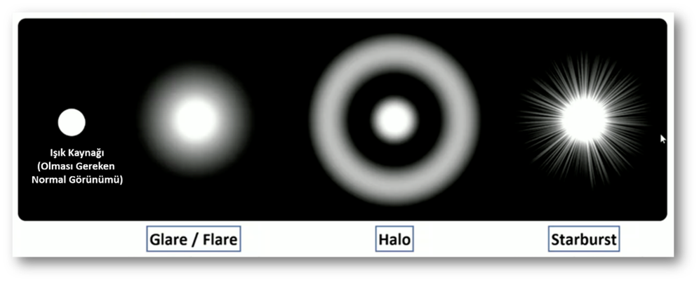 Hangi akıllı lens? Trifokal mi, EDOF mu? – Prof. Dr. İzzet Can – Göz ...